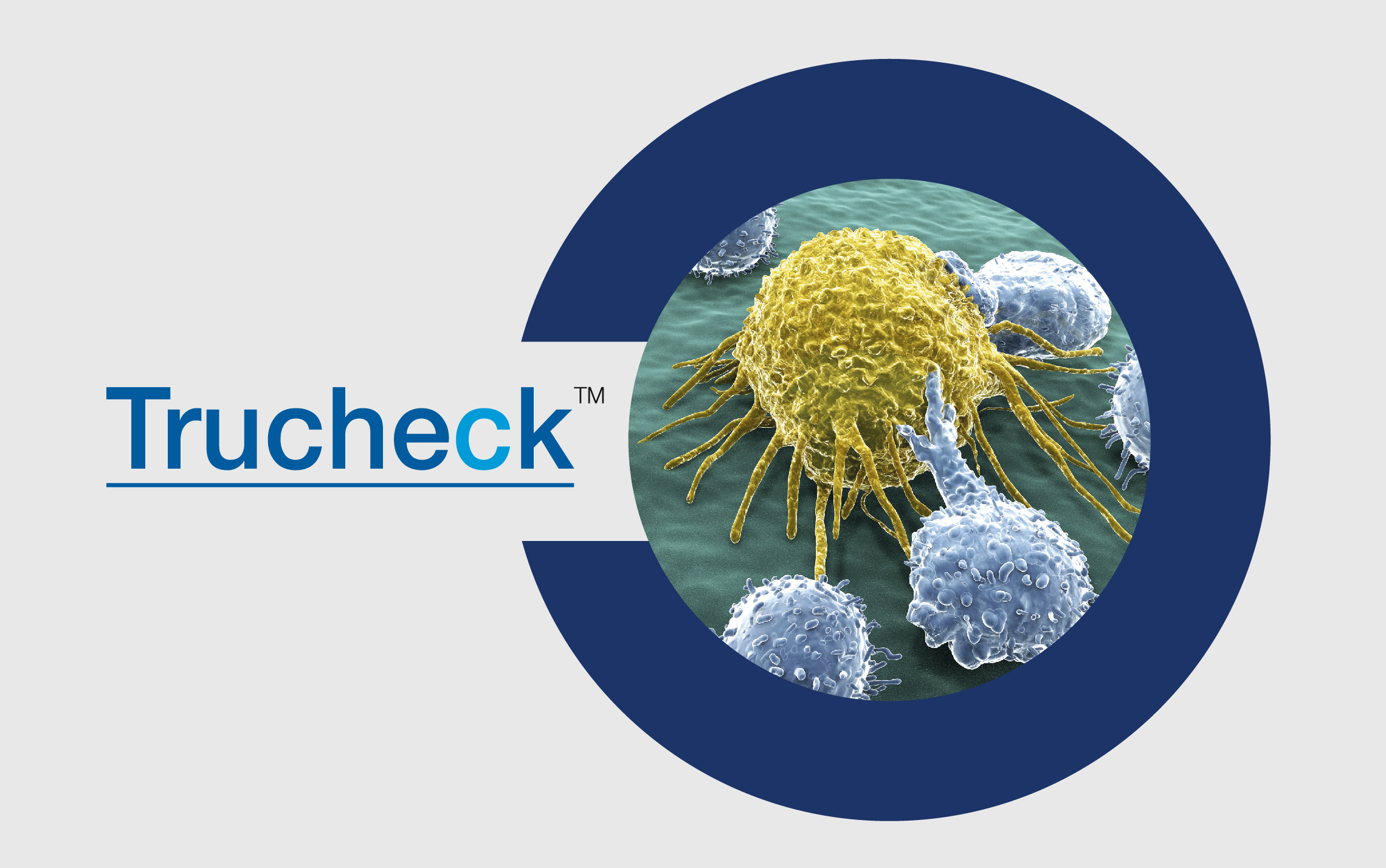 Innováció a rákszűrésben: Trucheck vérteszt a rák korai, tünetmentes ...